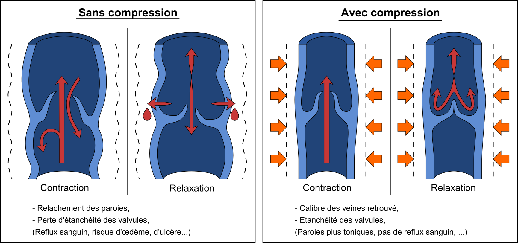 Compression / Contention – L'Orthesiste.fr